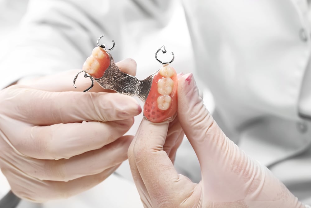 Restoring Old Or Broken Dental Implants and Bridges - Radiance Family ...